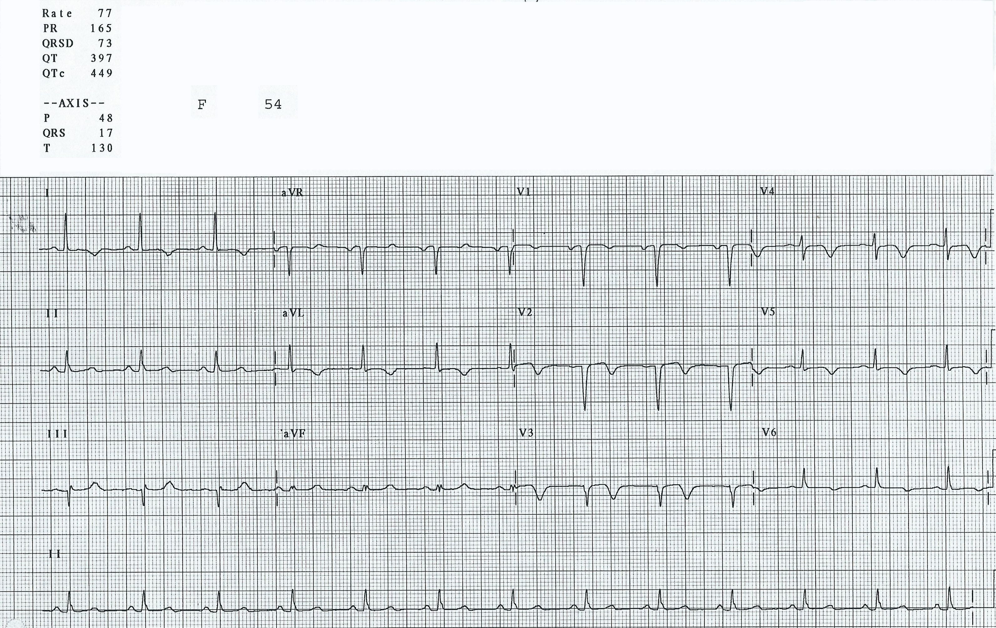 Recent M I Ecg Guru Instructor Resources